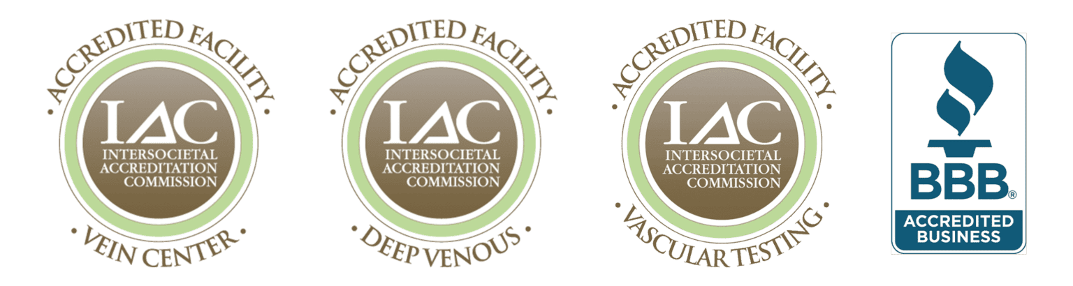 What Is Peripheral Artery Disease (PAD)? Early Symptoms You Shouldn’t ...