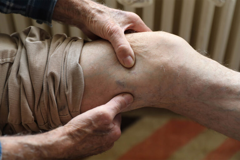 What Is Critical Limb Ischemia? Signs & Treatment Options