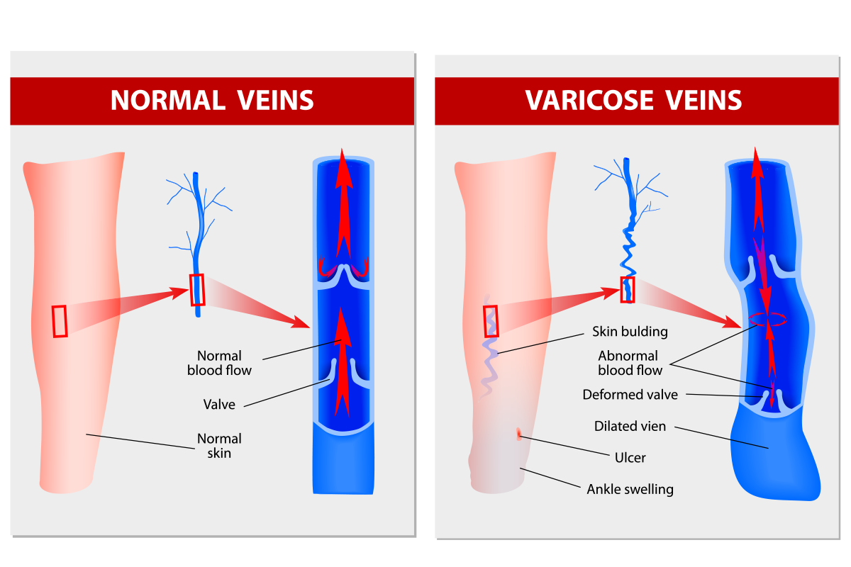 From Veins to Arteries: Complete Vascular Care for Every Stage of Life ...